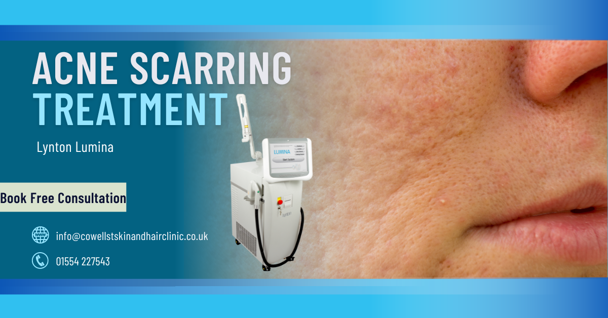 Acne scar - Cowell St Skin & Hair Cliinic